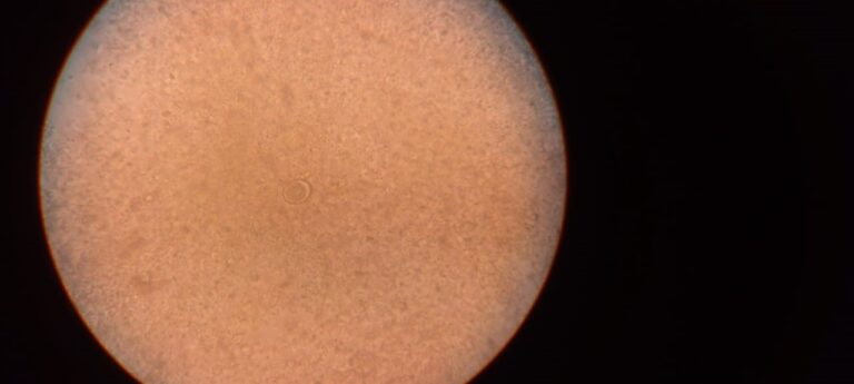 LARGE INTESTINAL COCCIDIOSIS WITHOUT INVOLVEMENT OF CAECA- A CASE ...