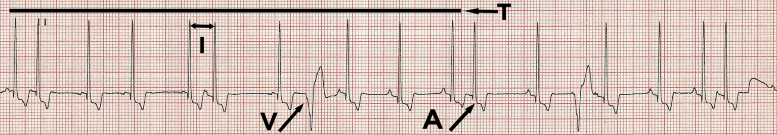 Reading ECGs (Electrocardiogram) in Dogs