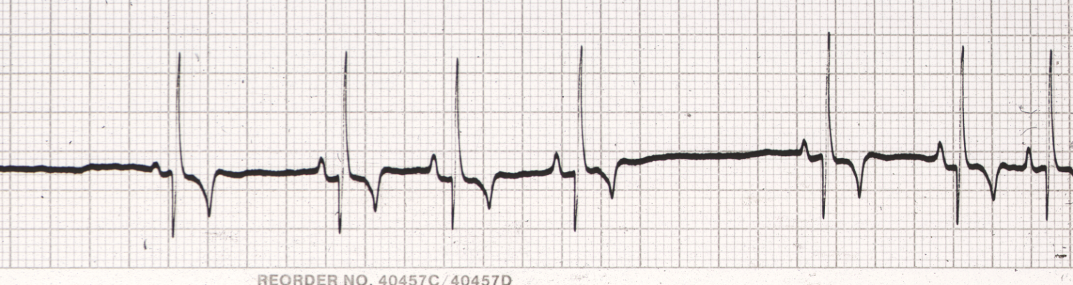 Reading ECGs (Electrocardiogram) in Dogs
